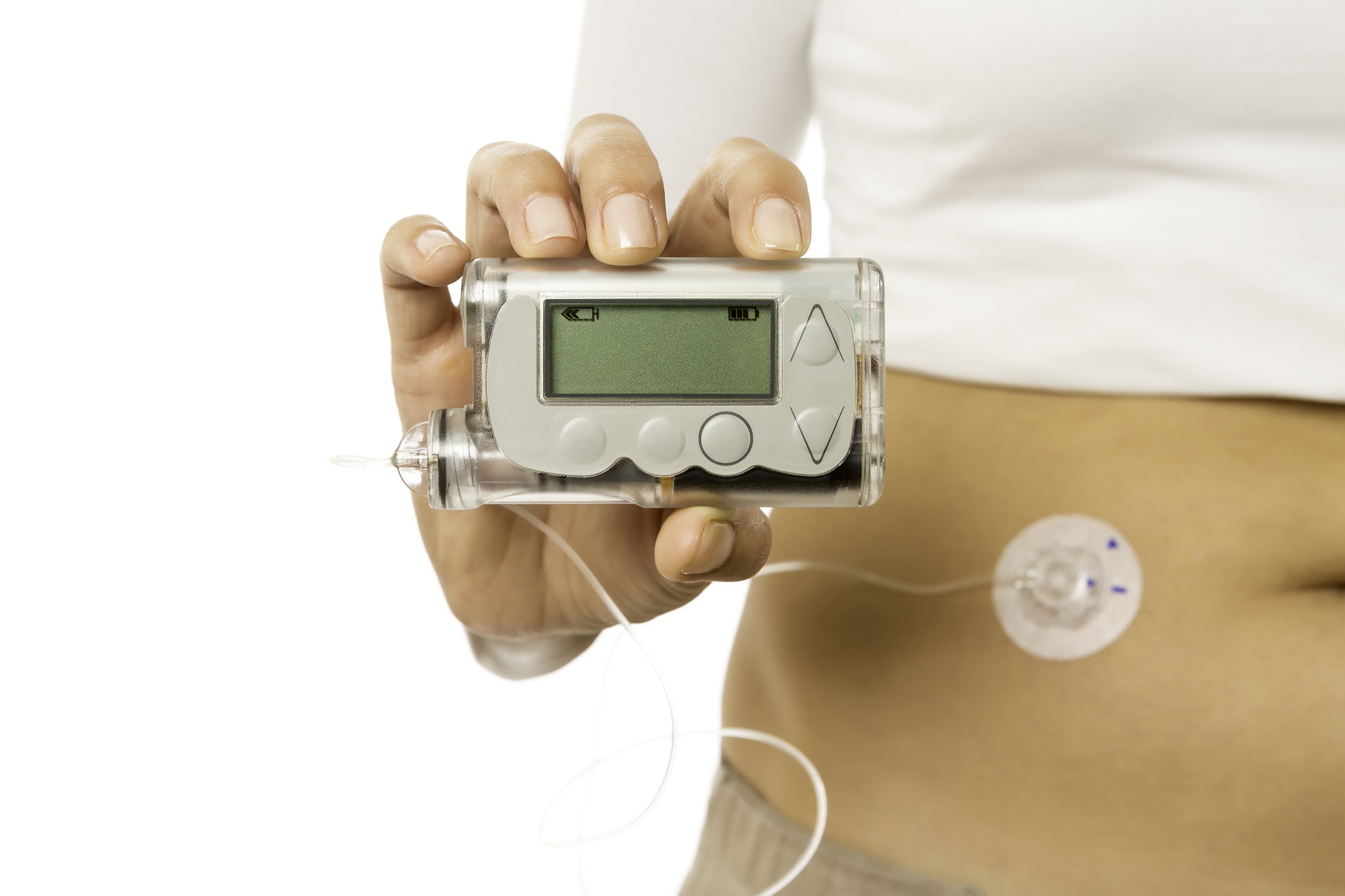 FDA Approves 1st Artificial Pancreas - AnswerGuide